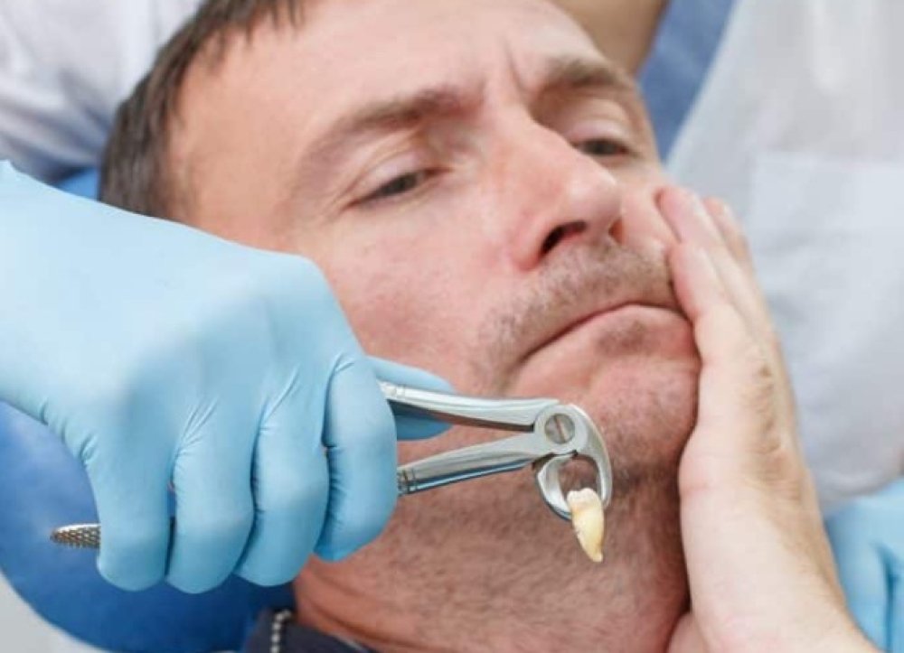 Kill Tooth Pain Nerve in 3 Seconds Permanently: Long Term Treatment